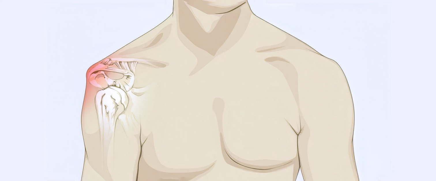 Shoulder Dislocation - The Complete Injury Guide — Vive Health