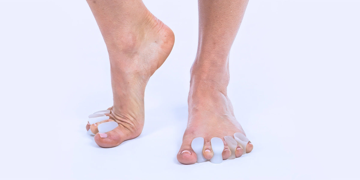 How to Straighten Overlapping Toes & Reduce Pain — Vive Health