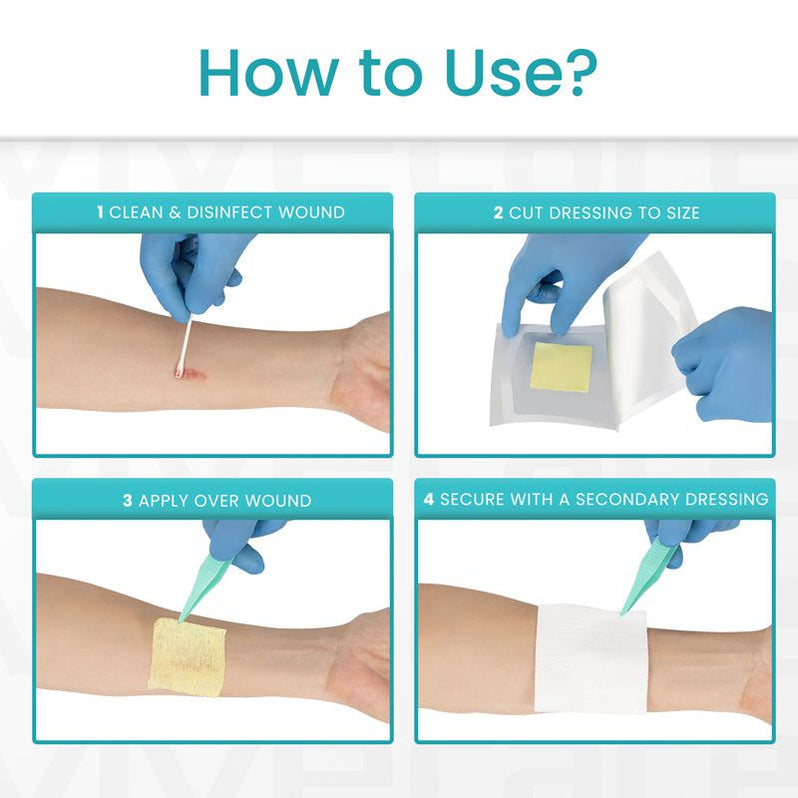 Xeroform Petrolatum Dressing — Vive Health