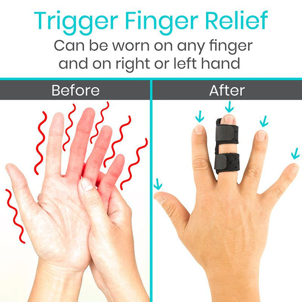 Universal Finger Splint - Vive Health